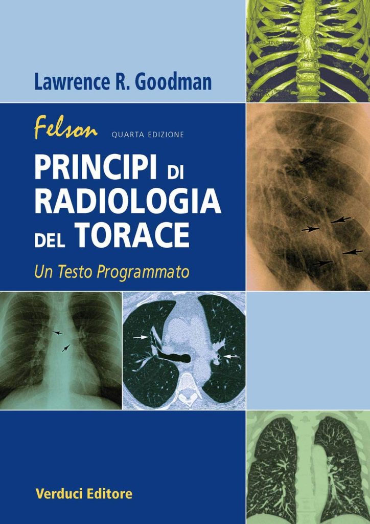 FELSON PRINCIPI DI RADIOLOGIA DEL TORACE – Medical Books